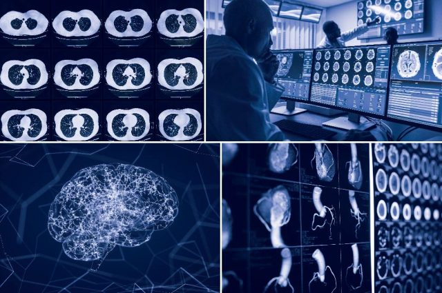 Radiology Workflow Challenges Solutions